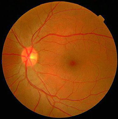 Iris Recognition vs. Retina Scanning - What are the Differences ...